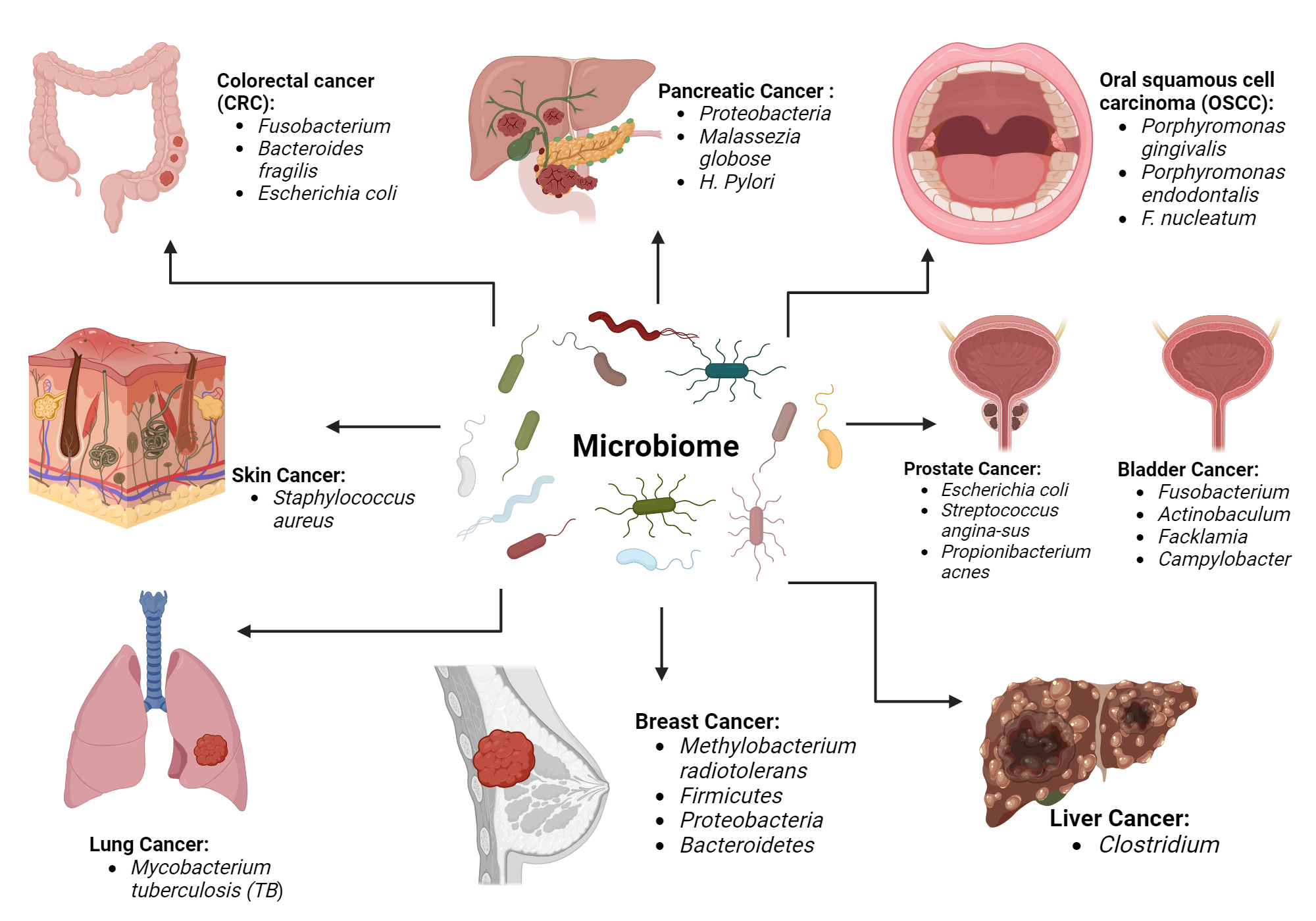 microbiome and cancers | BioRender Science Templates