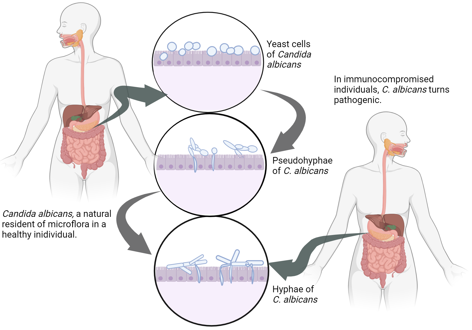 Candida albicans invasion in systemic infection | BioRender Science ... Candida albicans invasion in systemic infection | BioRender Science ...