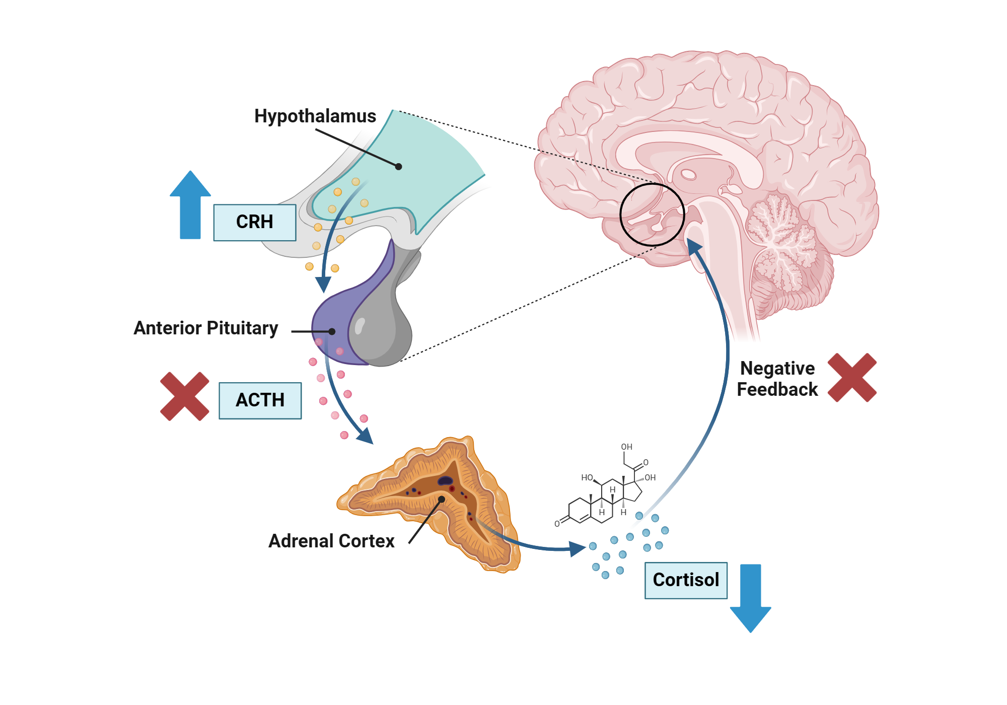 Hypothalamic Pituitary Adrenal Hpa Axis Dysregulation In Ptsd