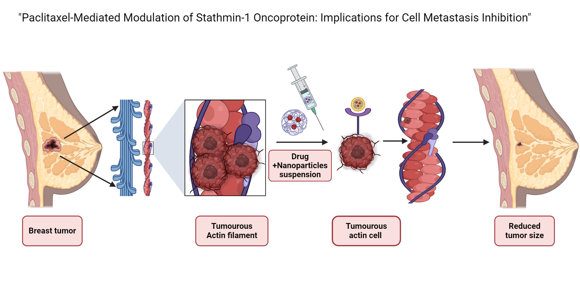Paclitaxel-Mediated Modulation of Stathmin-1 Oncoprotein:Implications ...