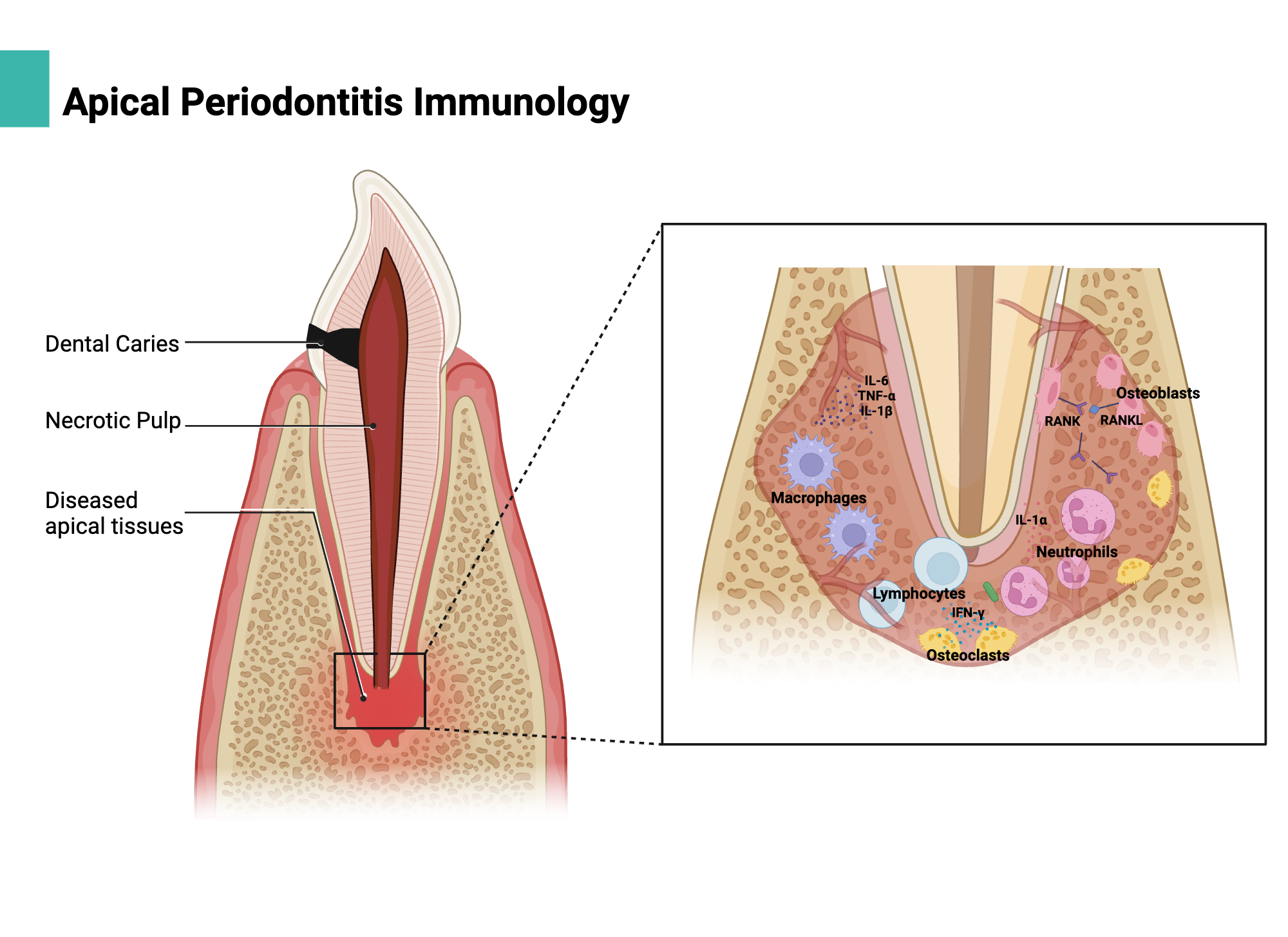 Apical Periodontitis Immunology | BioRender Science Templates