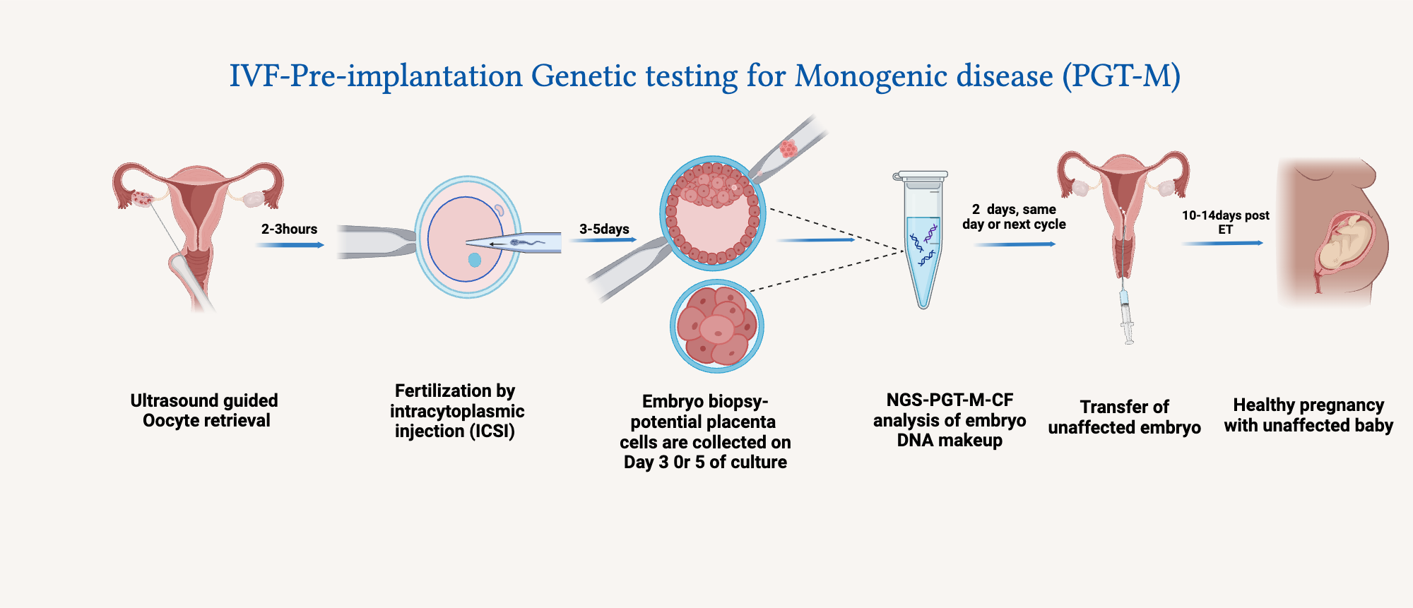 Invitro fertilization Pre-implantation genetic testing for monogenic ...