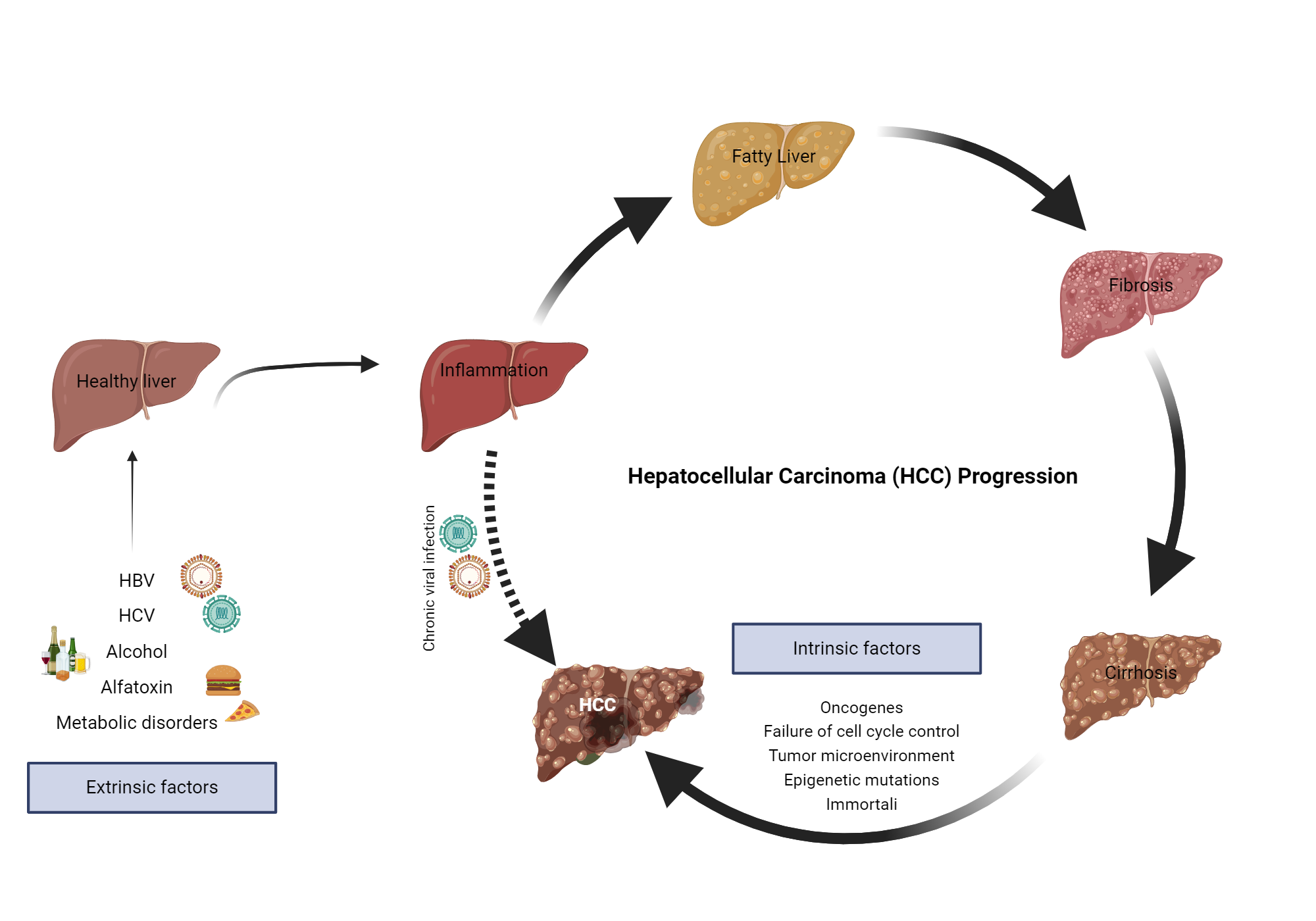 Schematic representation of multi-stage HCC development from common ...