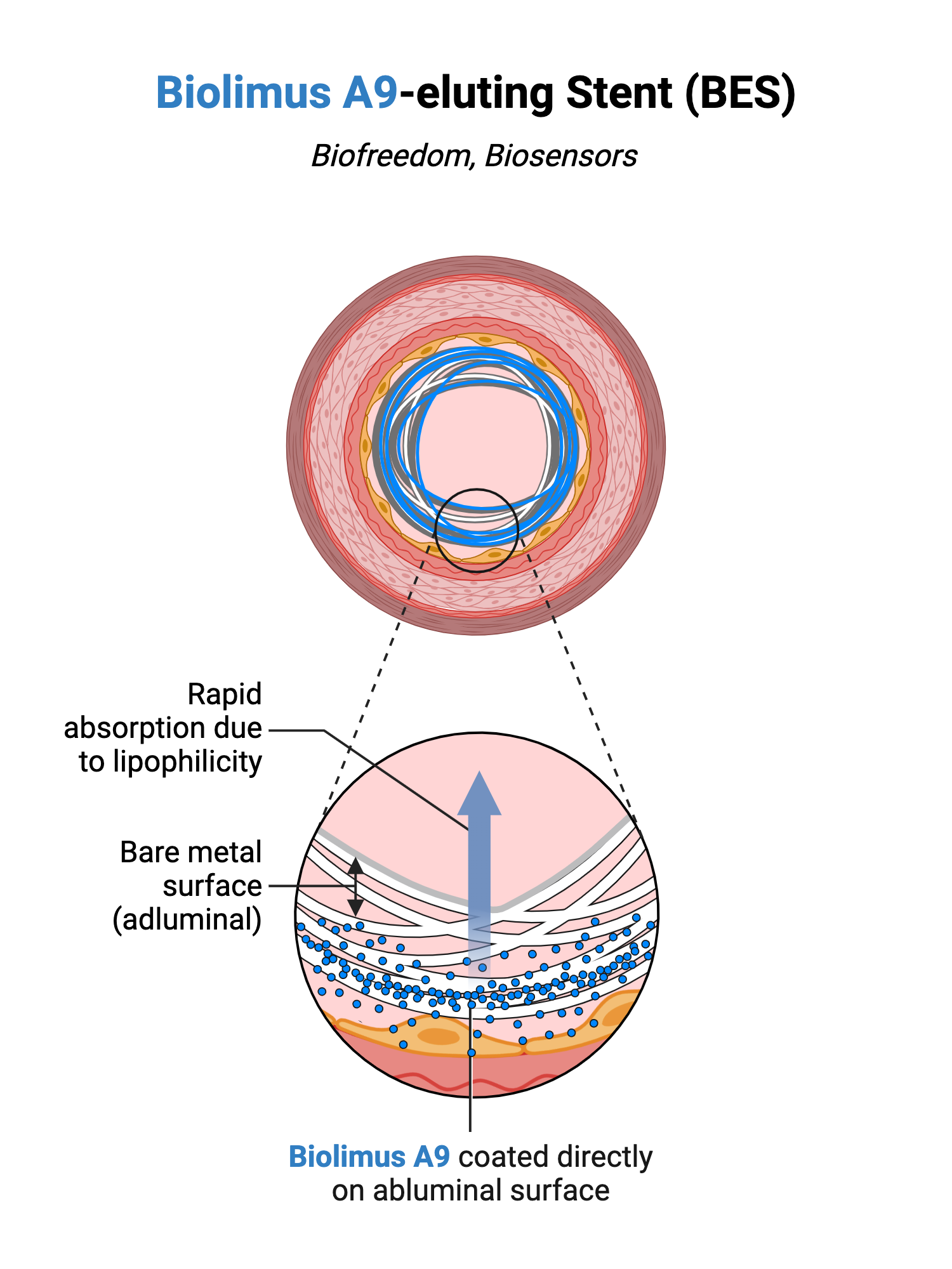 Biolimus A9-eluting Stent (BES) | BioRender Science Templates