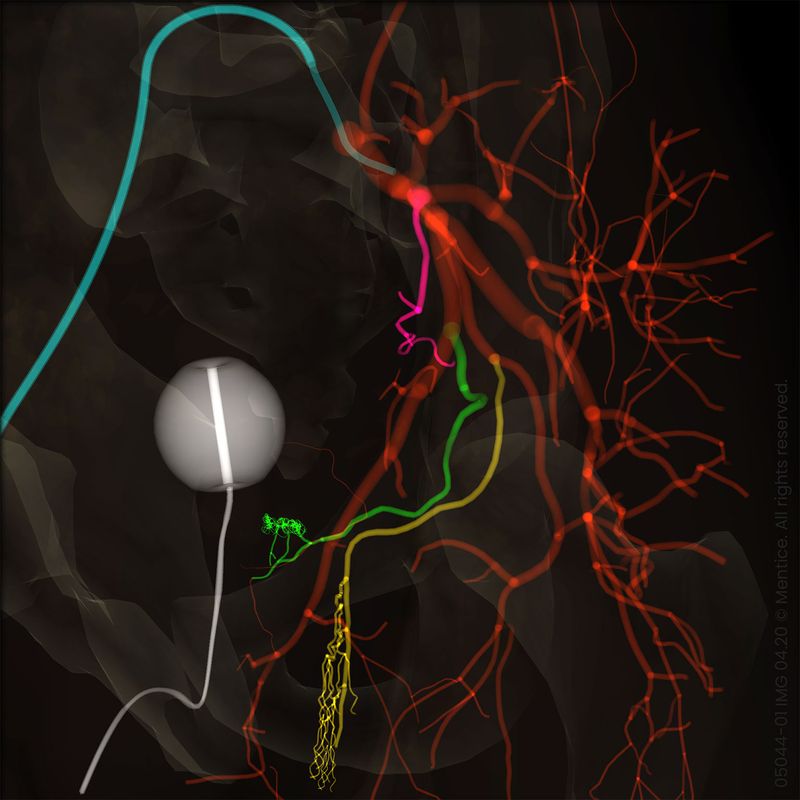 Peripheral Vascular procedural efficiency & proficiency