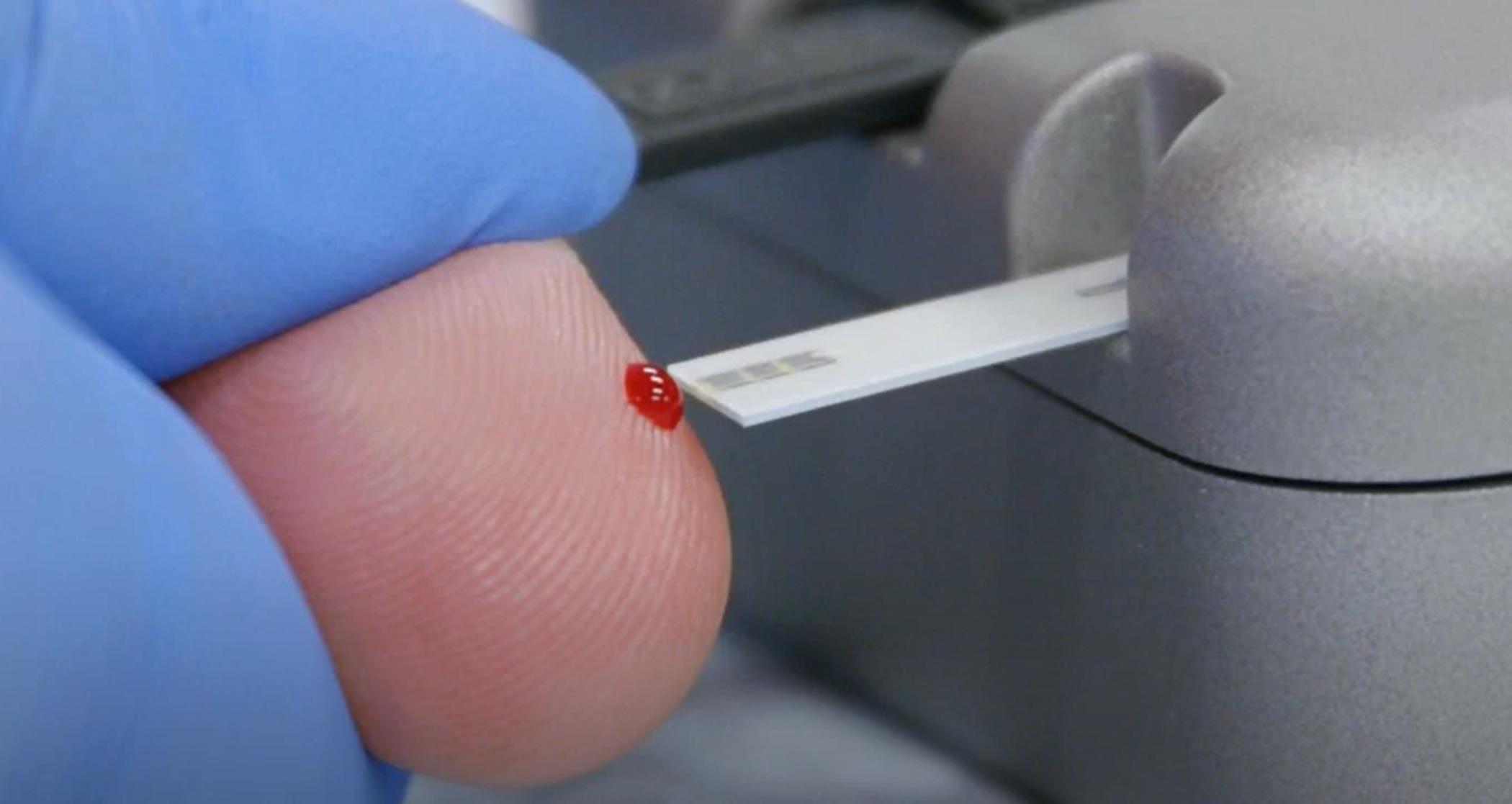 Safety Issue With an At-Home Cholesterol Test Kit