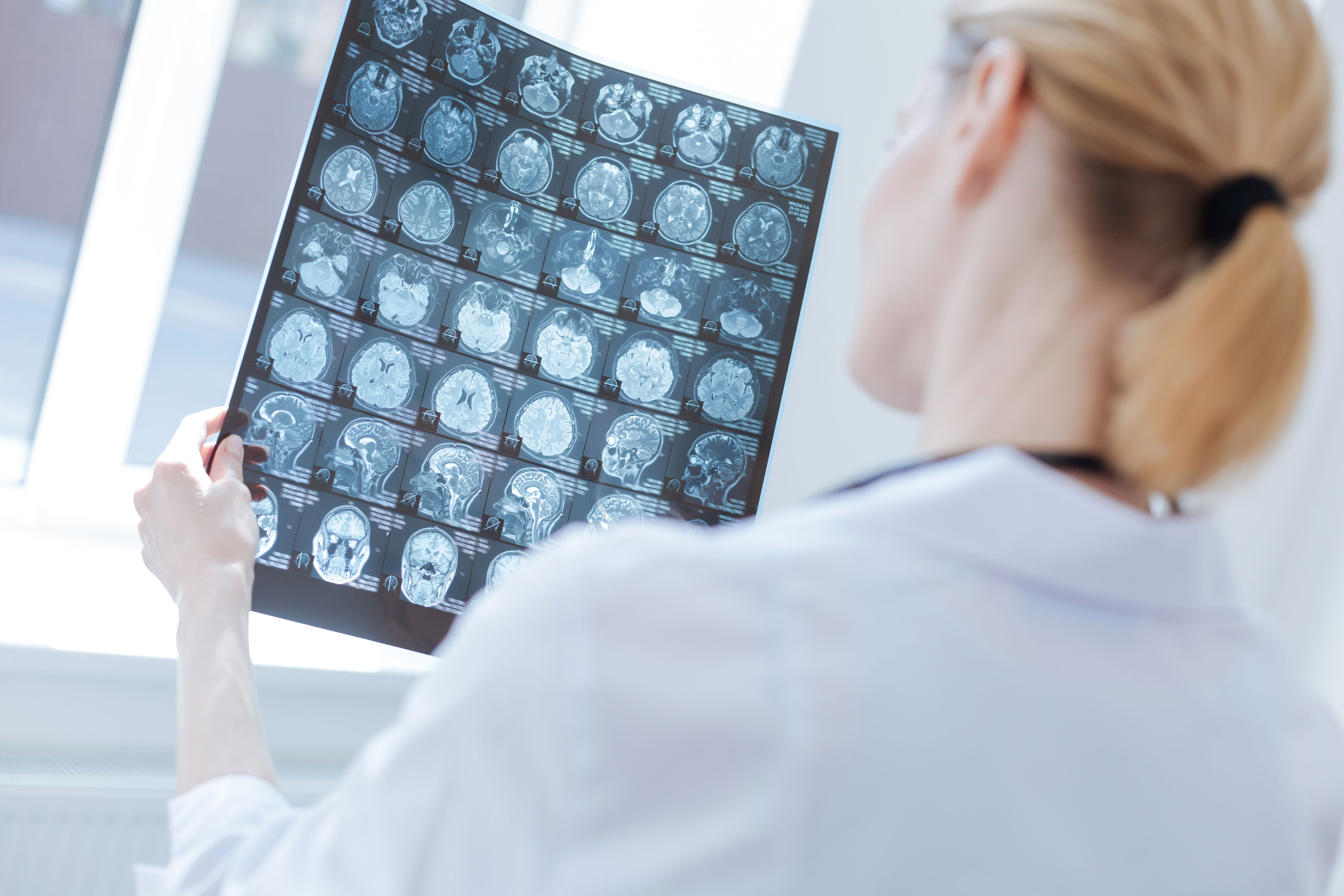 Tele Neurology: Improving Access to Neurological Care with Ceiba Health