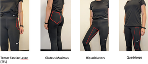 Iliotibial Band Syndrome (IT Band Syndrome) Exercises - Knee pain condition