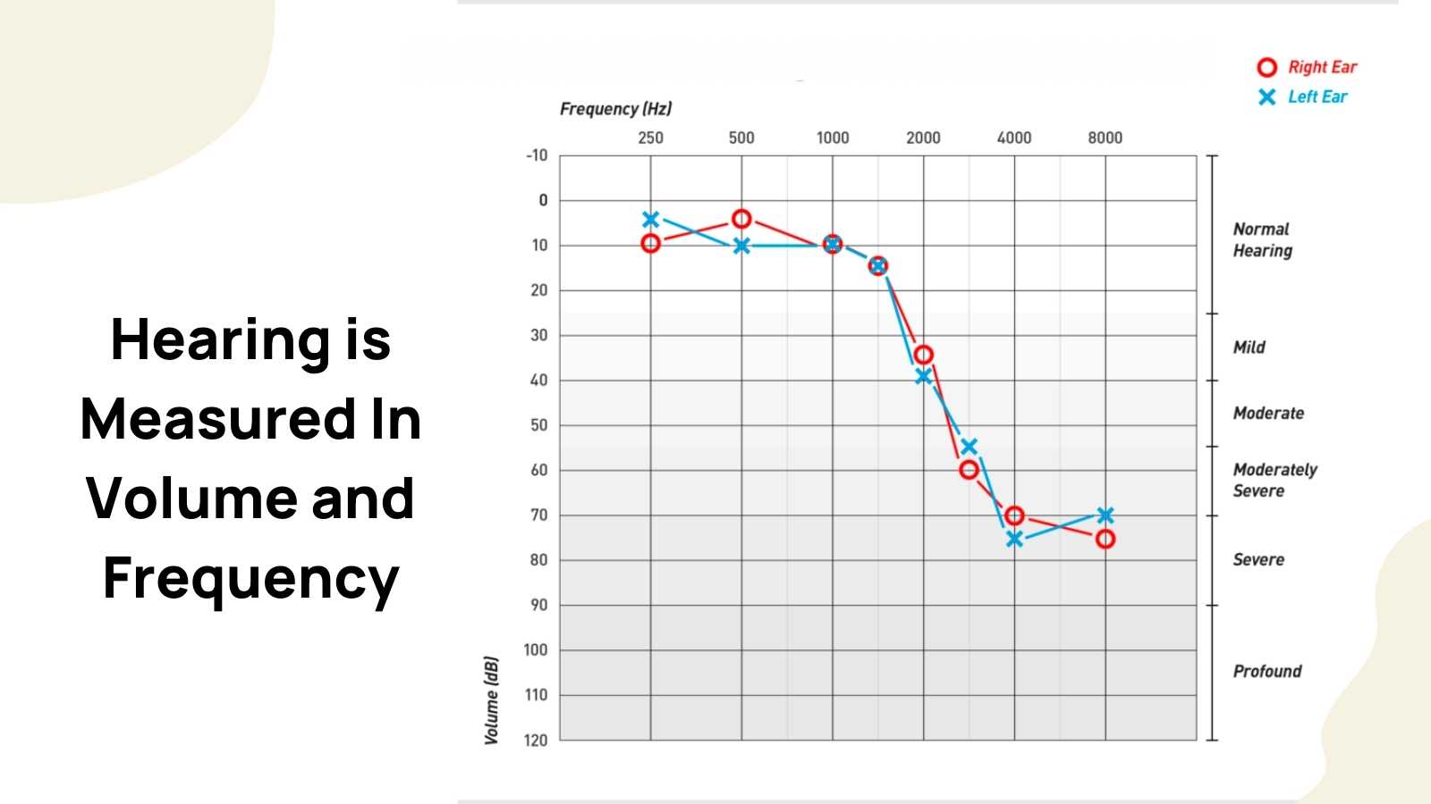 Normal Hearing Range Graph