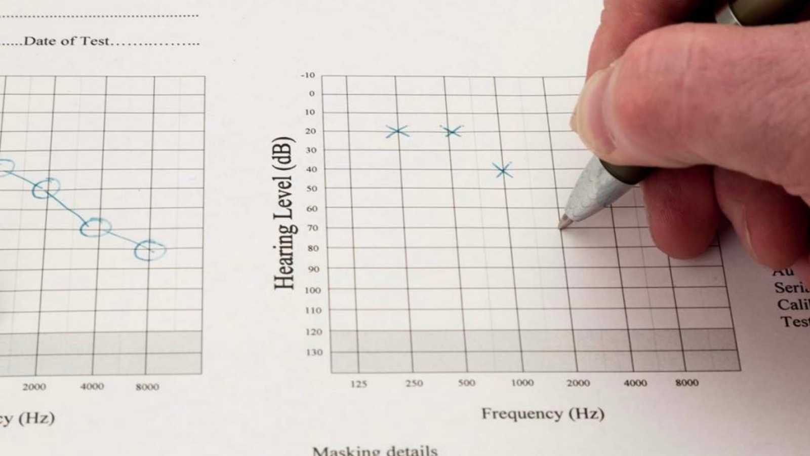 How to Read An Audiogram (Hearing Test)