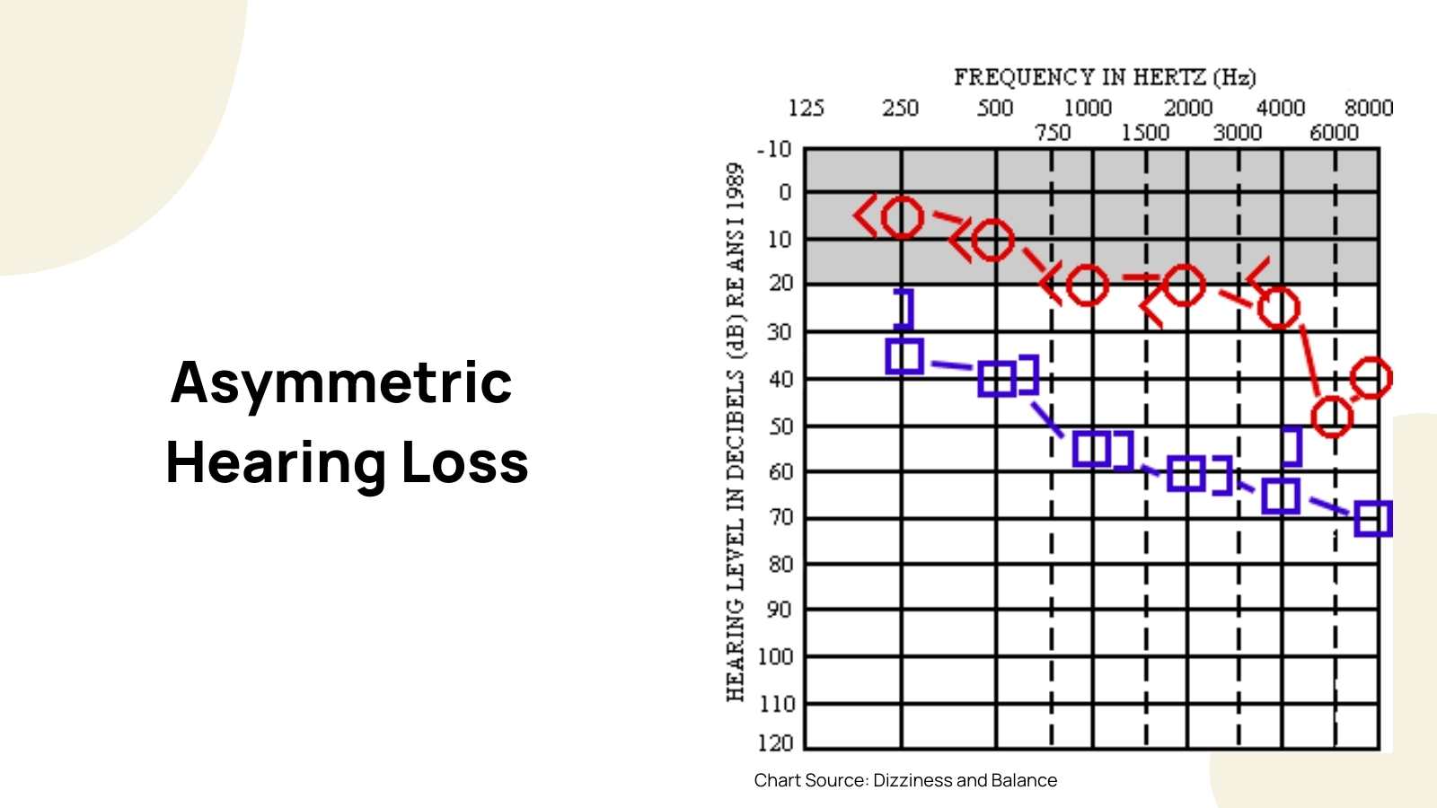 How to Read An Audiogram (Hearing Test)