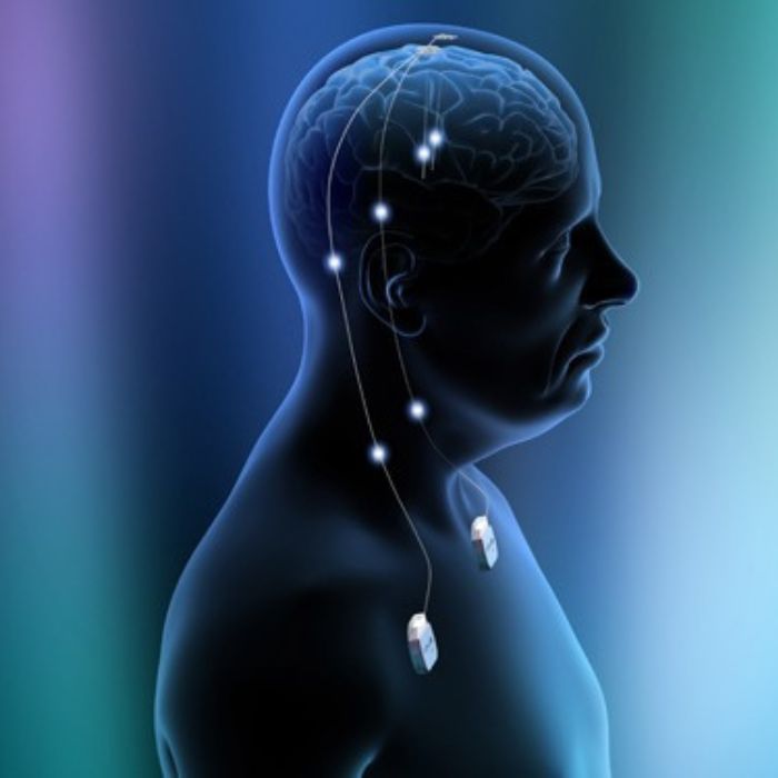 Neuromodulation and Bimodal Stimulation for Tinnitus: What’s The Science?