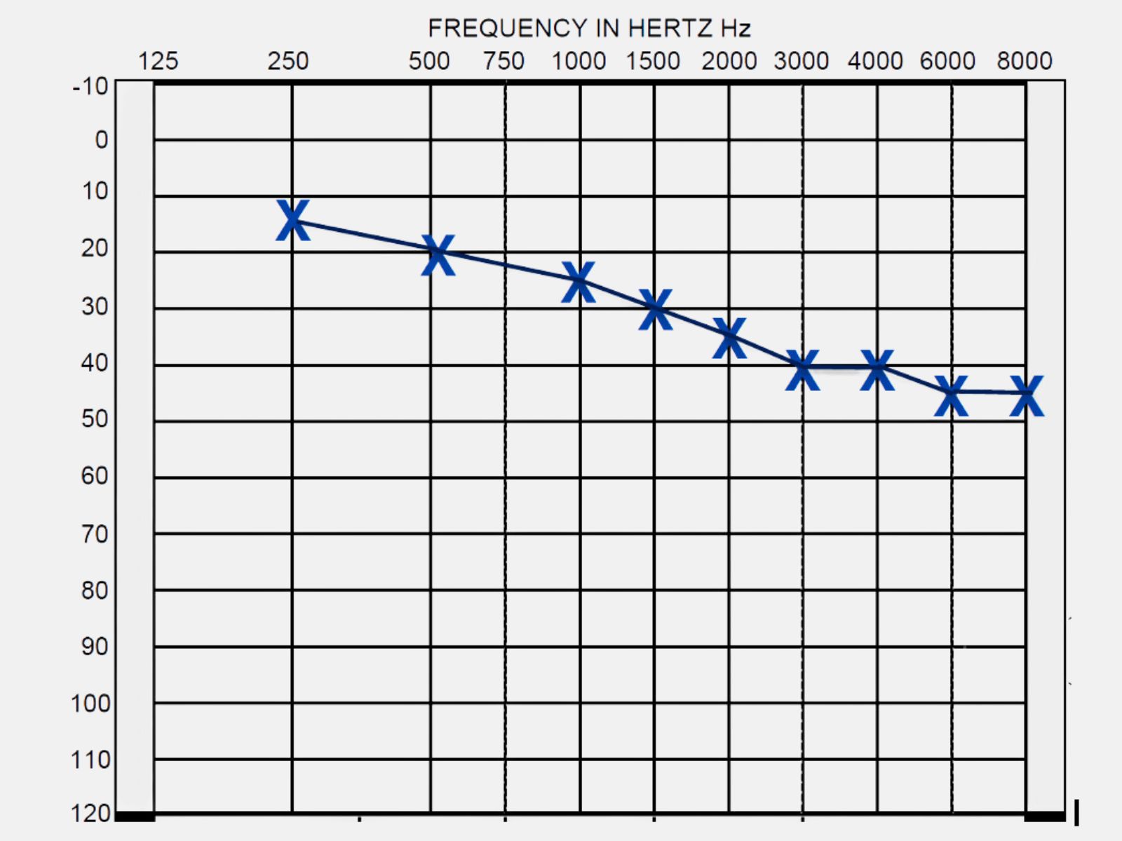 The Best Hearing Aids for High Frequency Hearing Loss