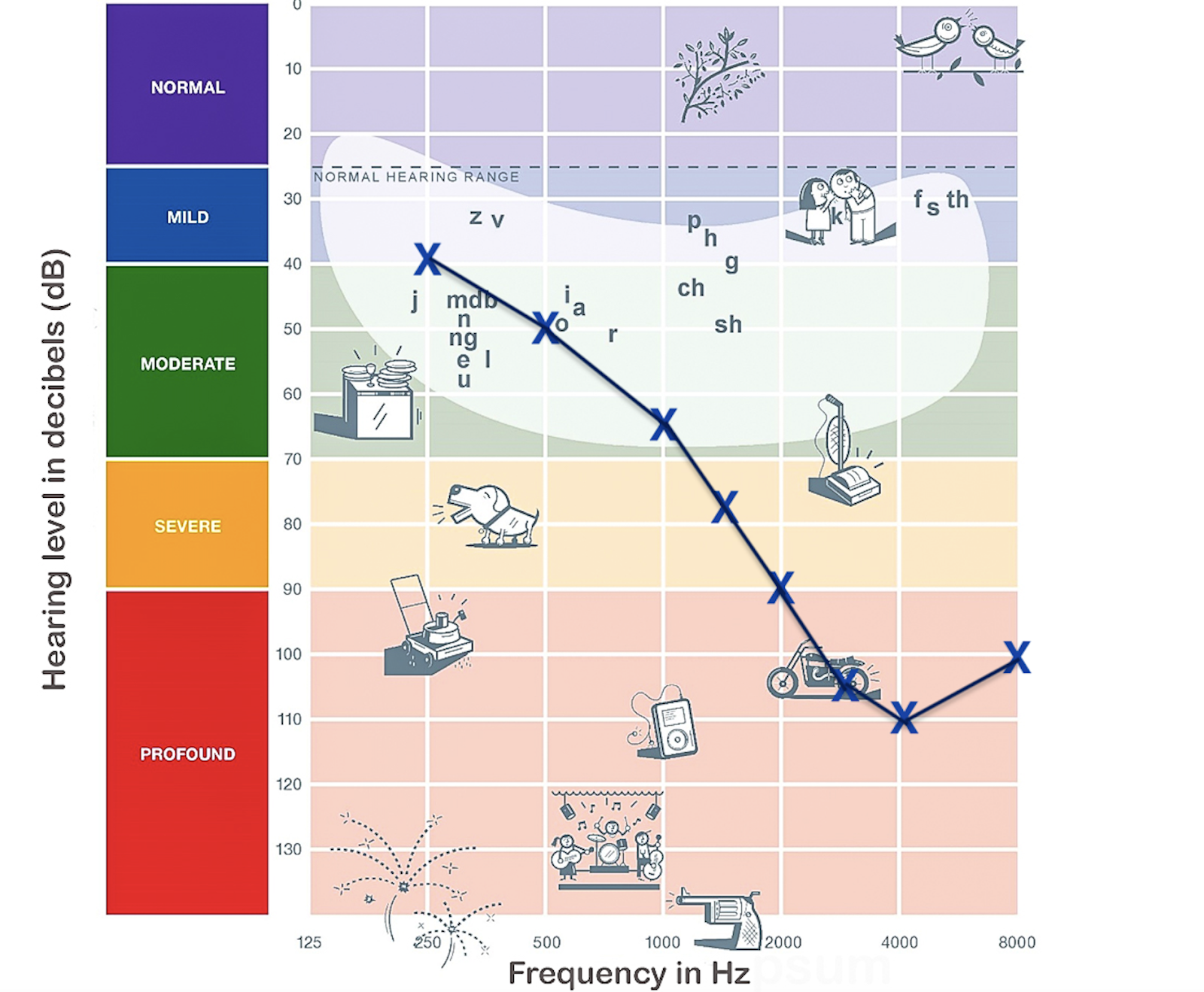 Costco Hearing Aids for Profound Hearing Loss