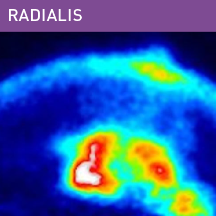 RADIALIS