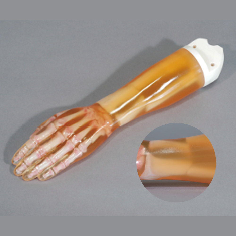 Kyoto Kagaku Unterarm-/Handphantom mit Frakturen | EMK4 Medical