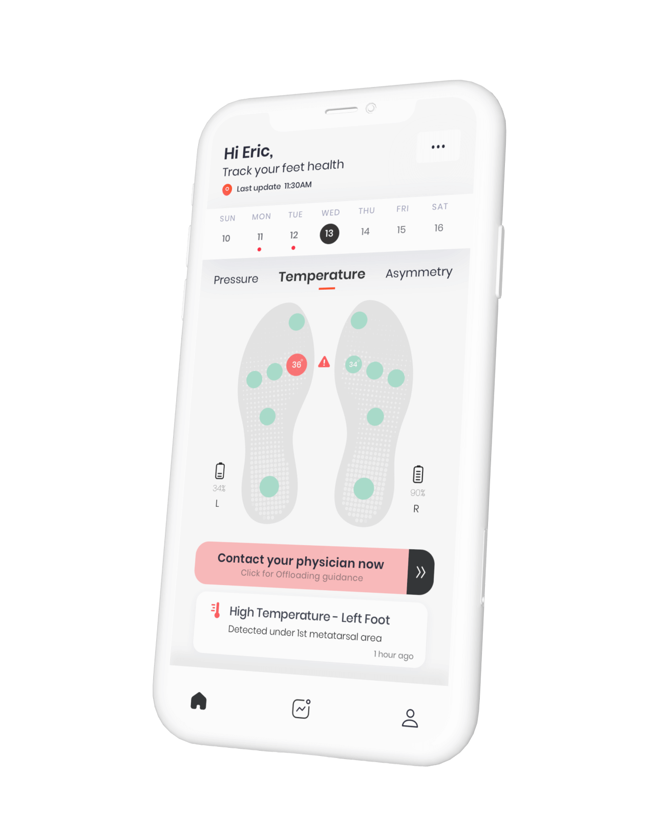 Actics - Digitizing the future of foot therapy