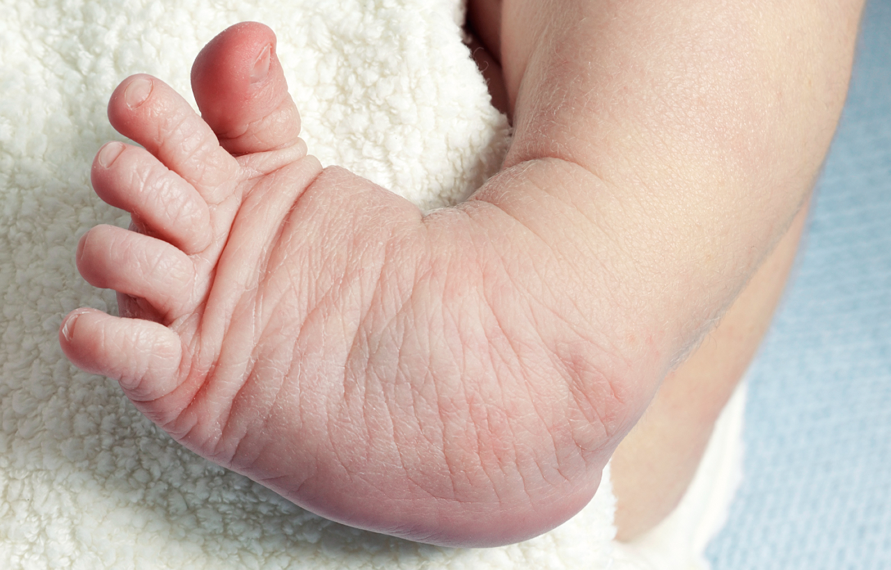 Expert Pediatric Podiatrists | Signature Foot & Ankle