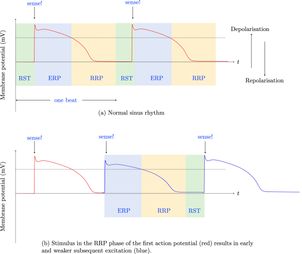 Pacemaker design and human heart model | Collimator