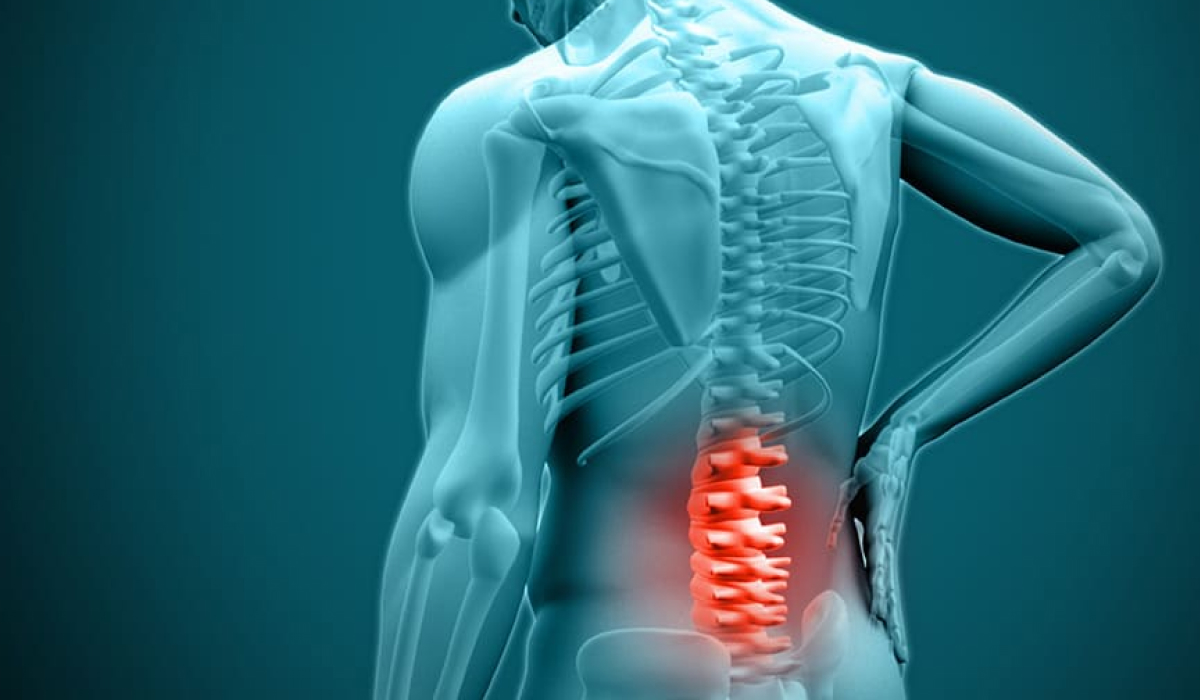 Leven Met Herniapijn? Wij Bieden Persoonlijke Oplossingen Voor Herstel ...