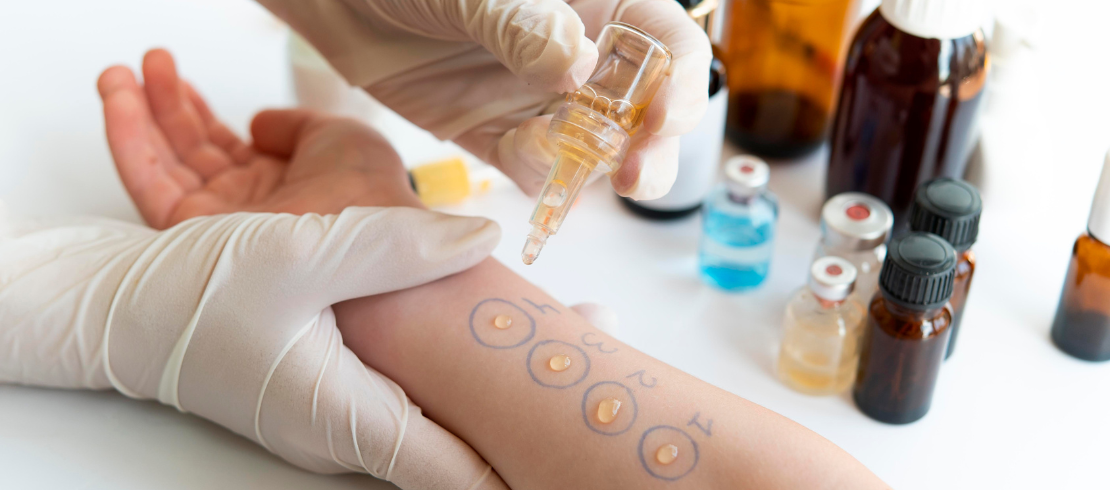 Skin Allergy Test: Understanding Your Options | HealthAssure