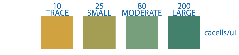 Your guide to Hematuria or Blood in Urine