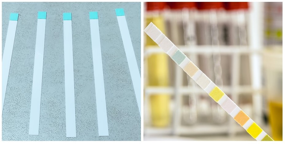 All About Glucose in Urine and Urine Glucose Test Strips