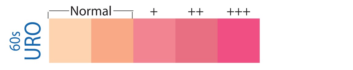 10 Parameter Urinalysis Test at Home