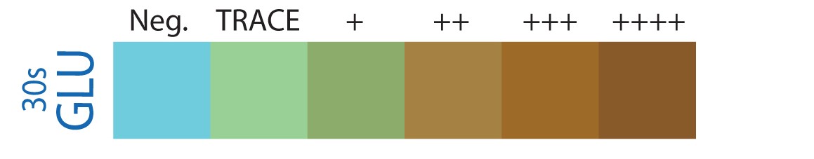 10 Parameter Urinalysis Test at Home
