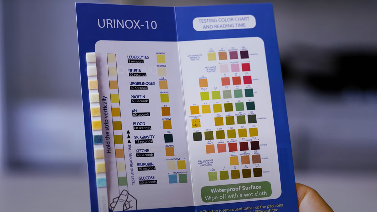 Tips To Avoid Color Bleeding on Multiparameter Urine Test Strips