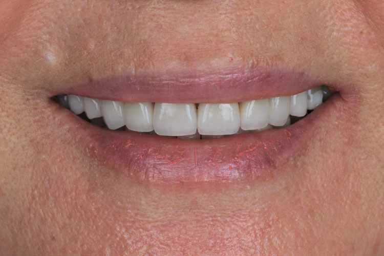 Smile Gallery | Livewell Dental Practice