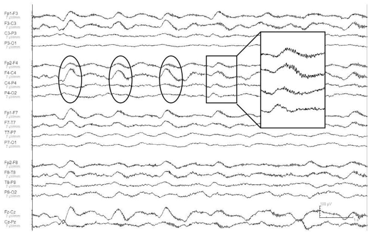 EEG Fun Facts: CAPE | Nov 10, 2023