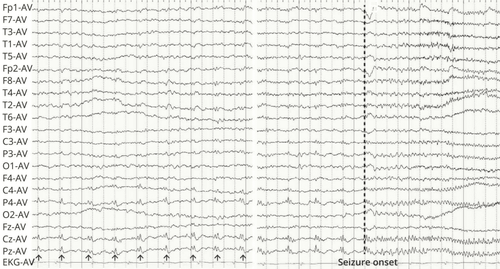 EEG Fun Facts | New Every Friday | Neuro Pathway