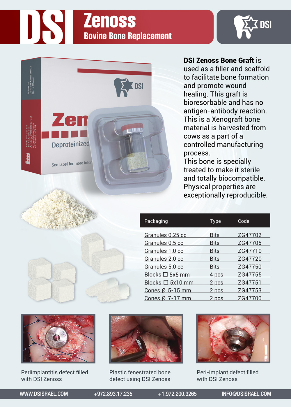 DSI Sponge Graft | Discover Dental Products & Solutions