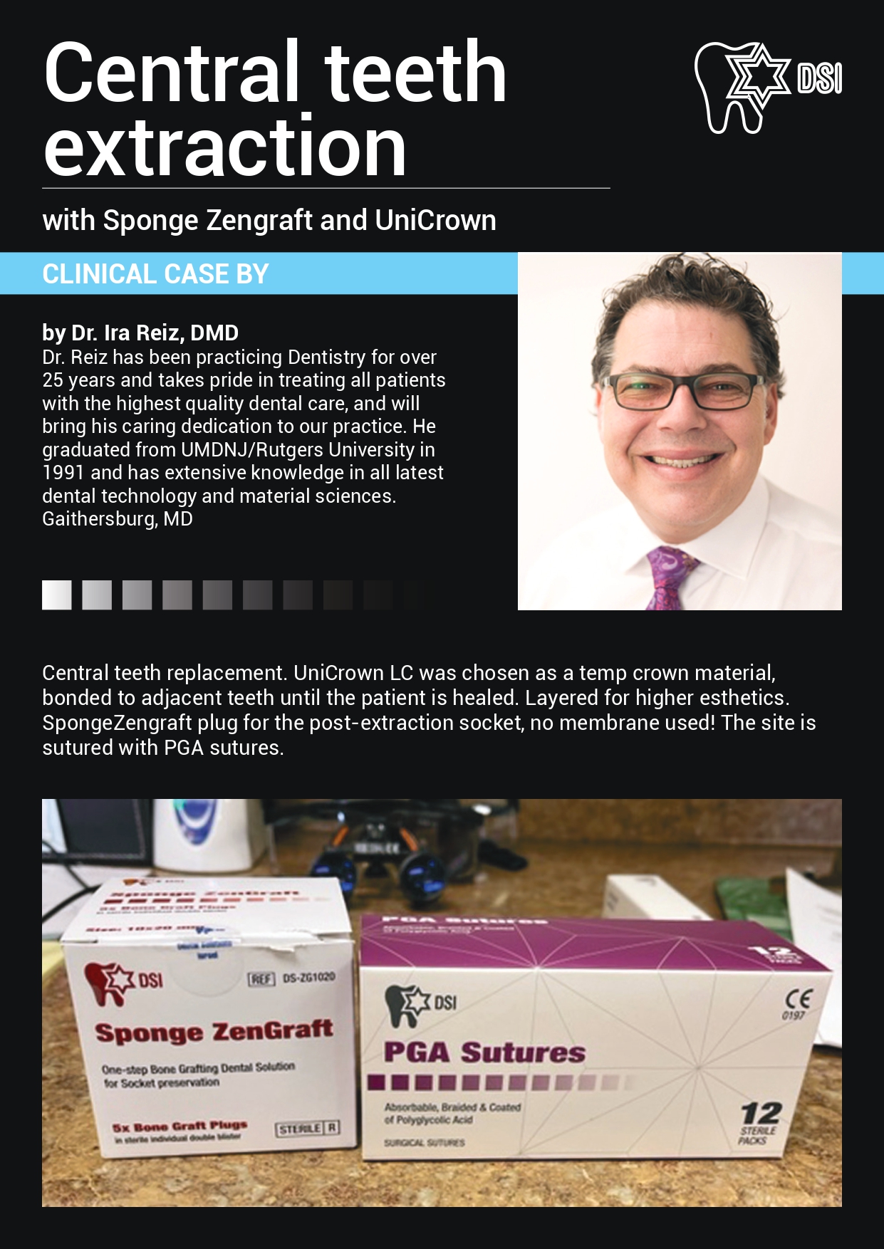 Case Study: Central Teeth Extraction with Sponge Zengraft and UniCrown ...