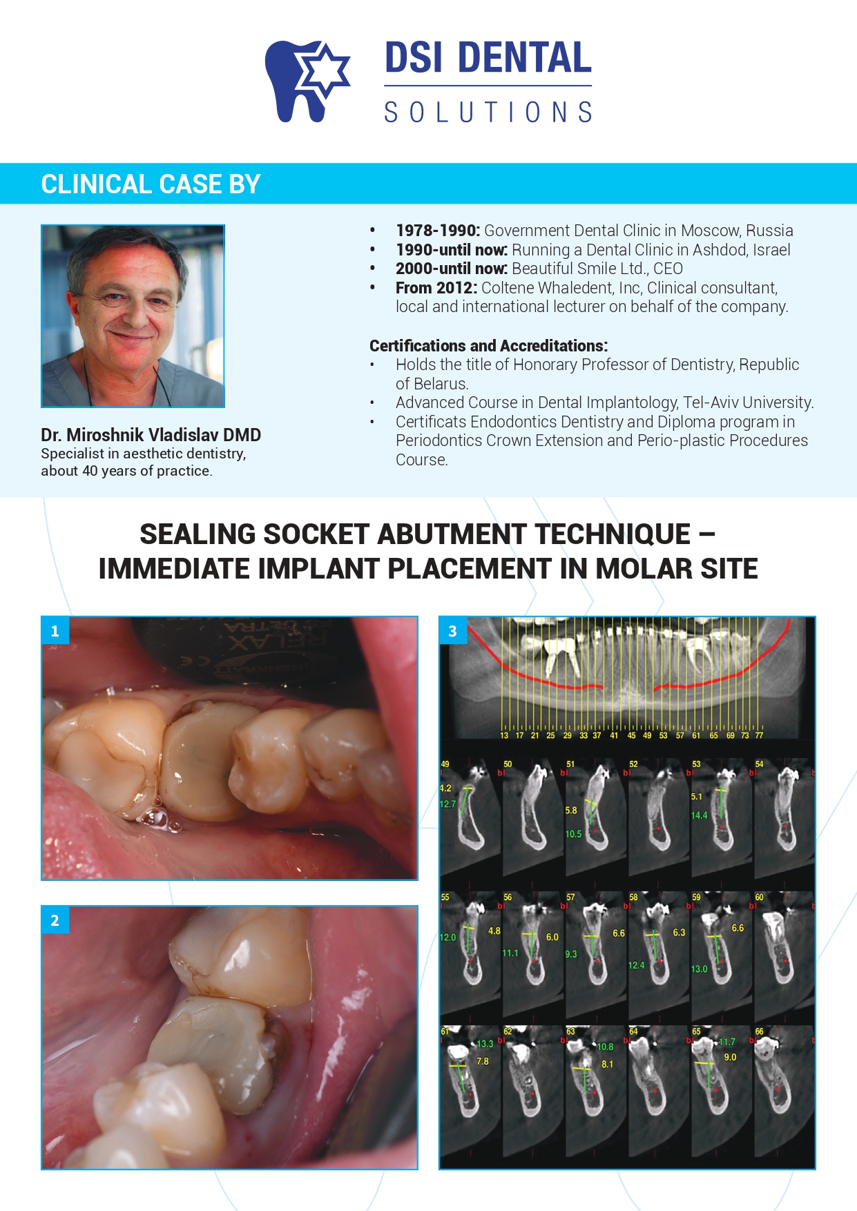 Case Study: Sealing Socket Abutment Technique - Immediate Implant ...