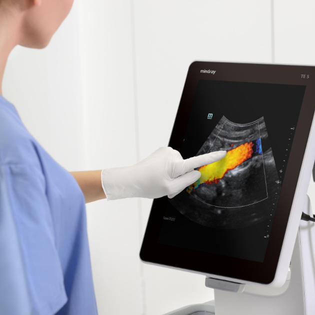 Mindray TE5 - Ultrasound System | Biomed Plus