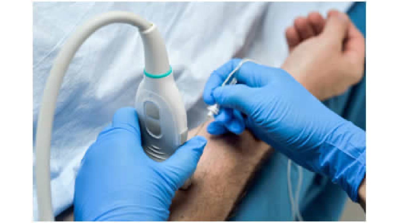 Mindray TE5 - Ultrasound System | Biomed Plus