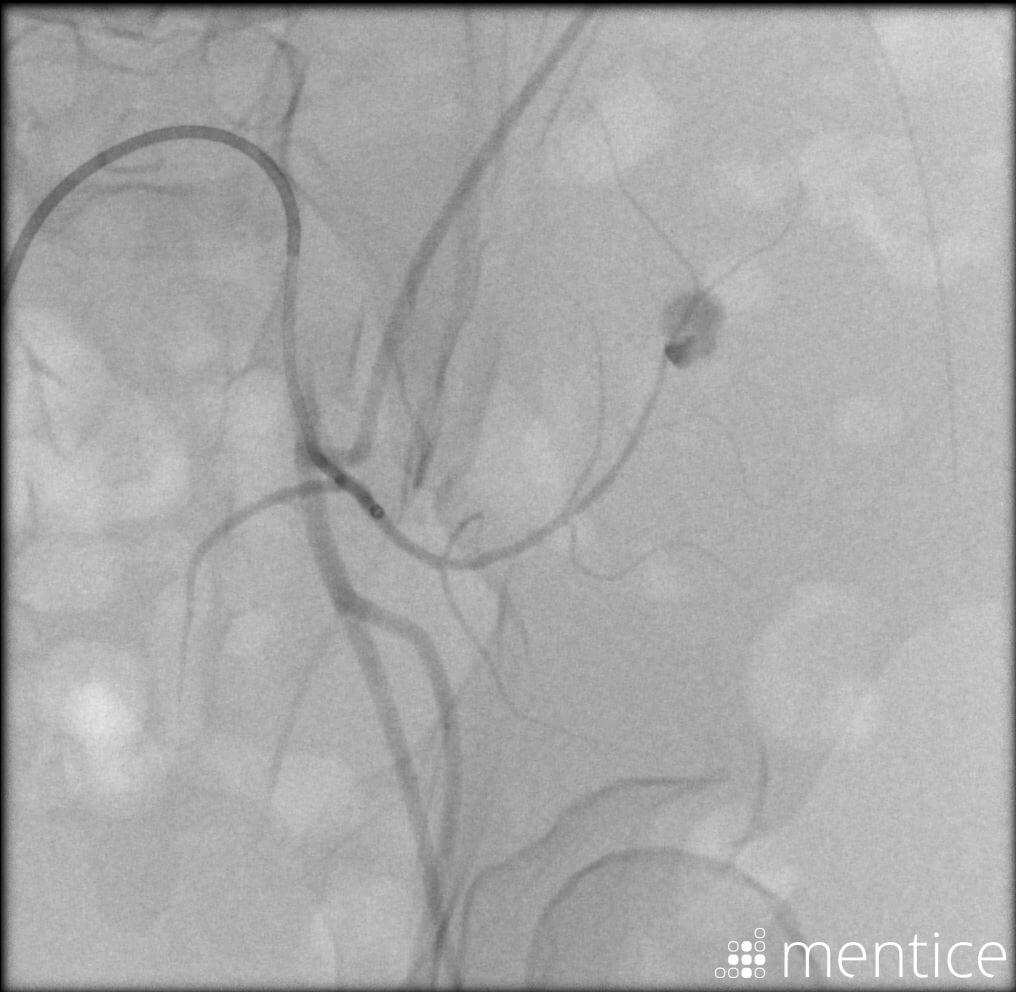 Vascular Trauma Management | Software