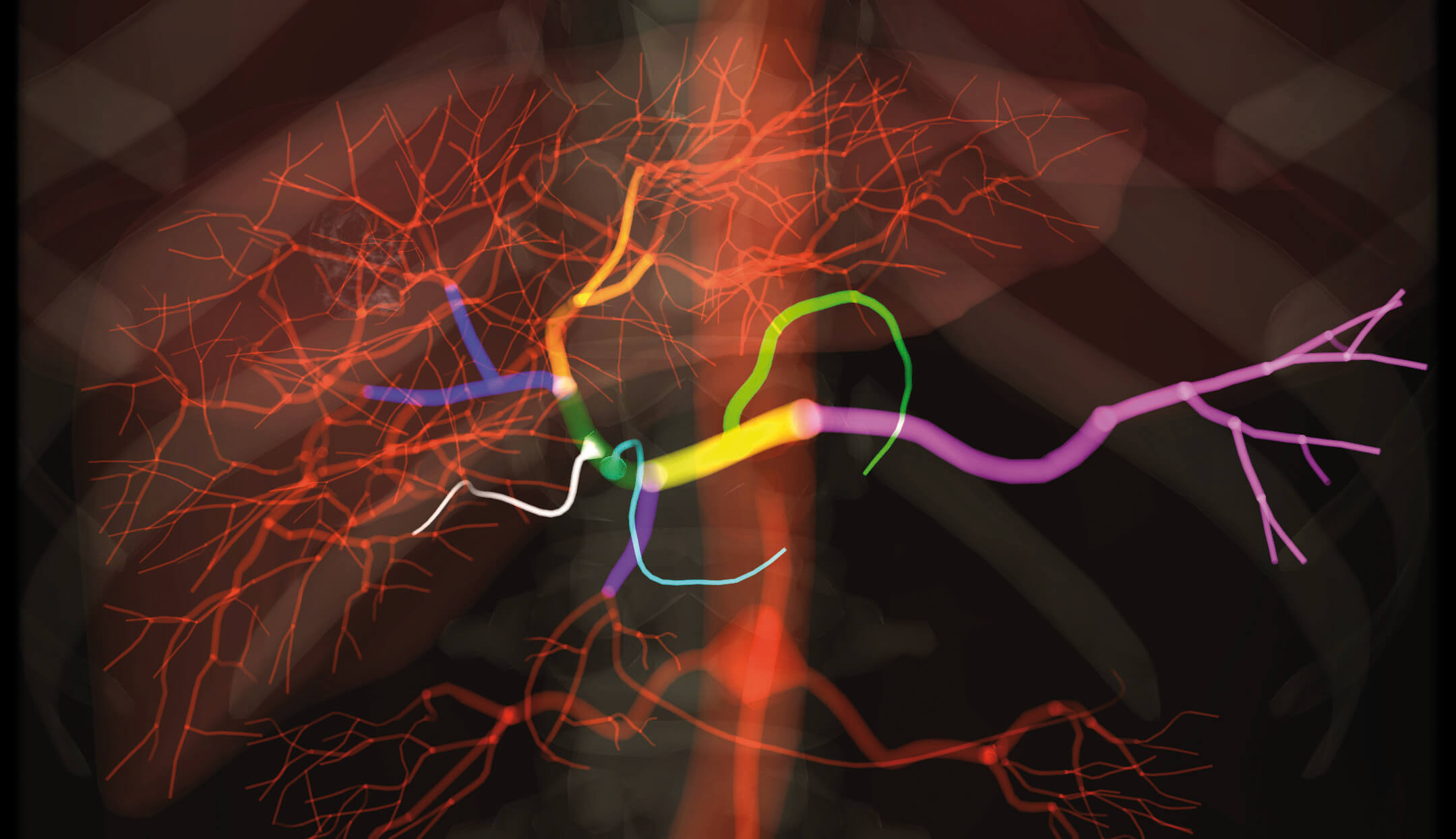 Transarterial Chemoembolization | Software