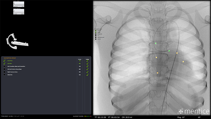 Coronary Essentials | Software