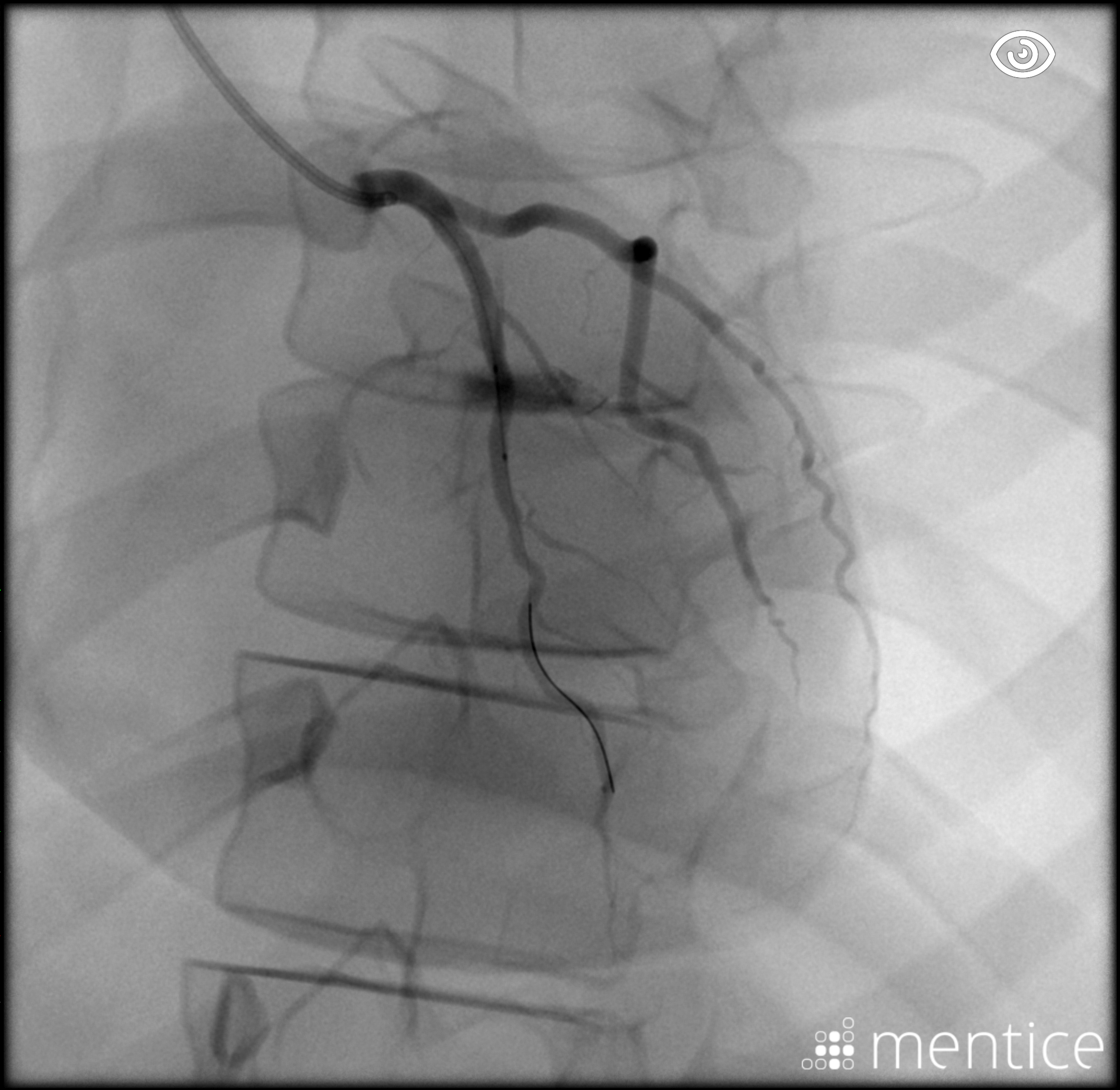 Coronary Advanced | Software