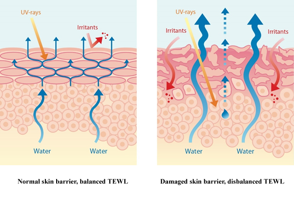 Is Aqueous Cream Really Good for Your Eczema?