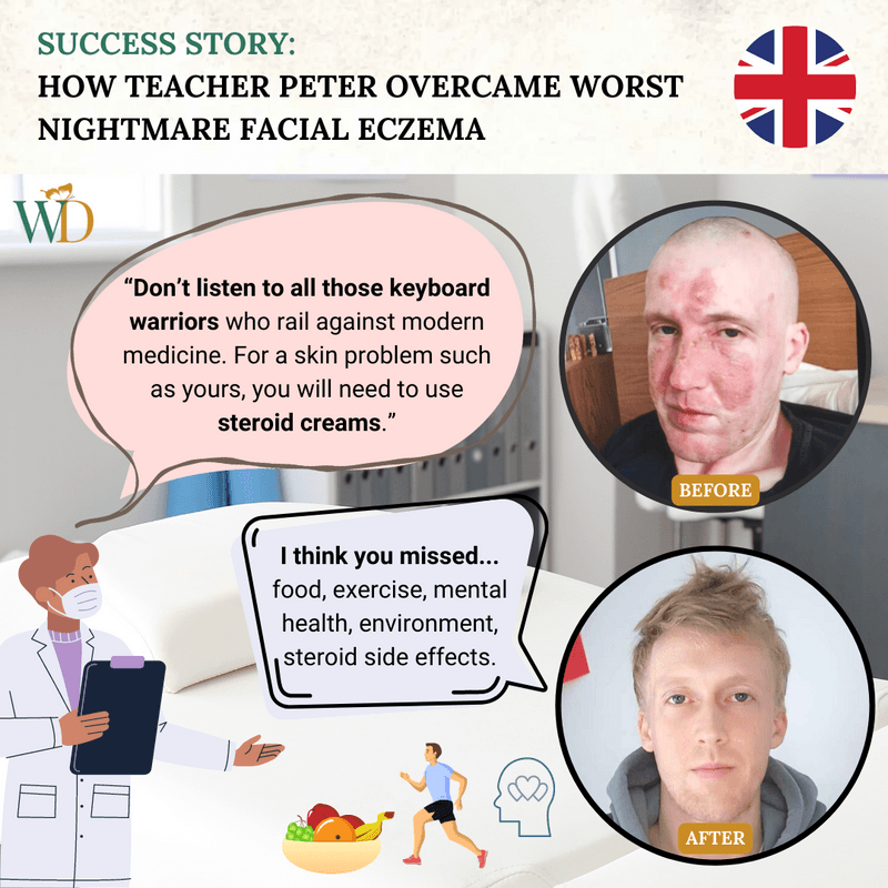 Success Story: How Teacher Peter Overcame Worst Nightmare Facial Eczema
