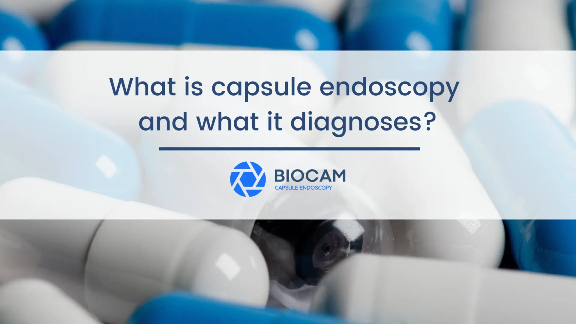 What is capsule endoscopy, and what it diagnoses? | BioCam
