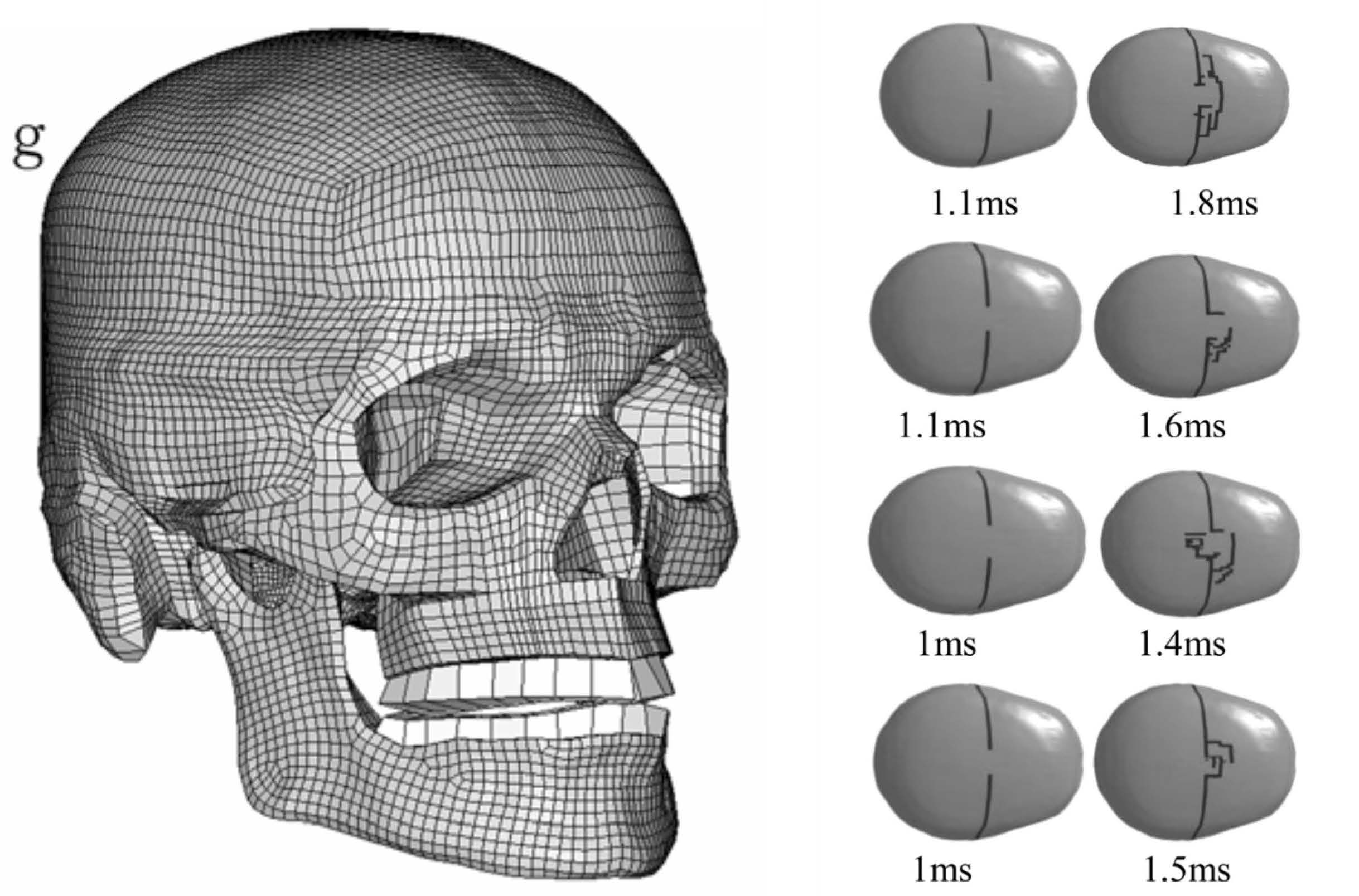 The Science of Skull Fracture