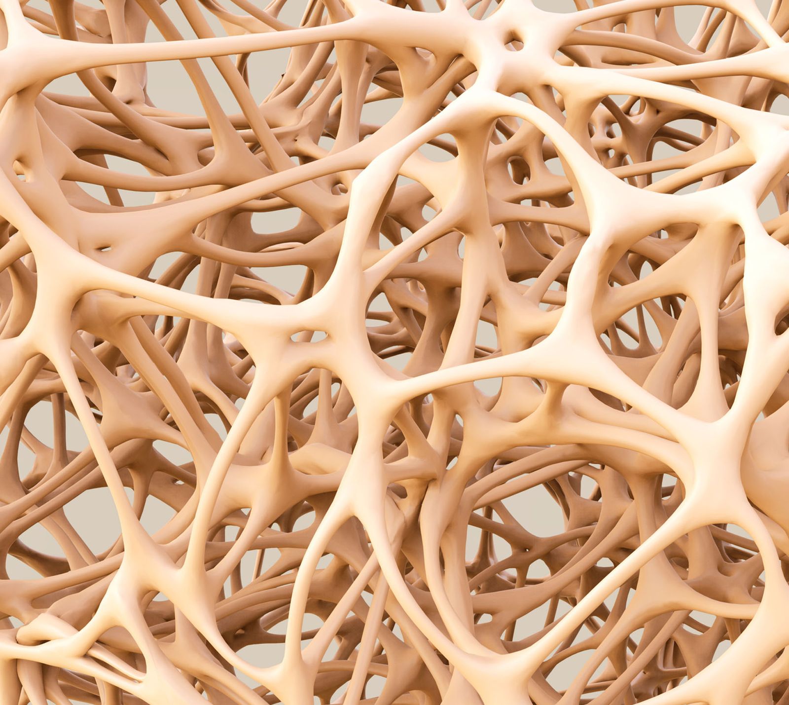 Bone Densitometry (DEXA) in Lincoln, NE - Advanced Medical Imaging