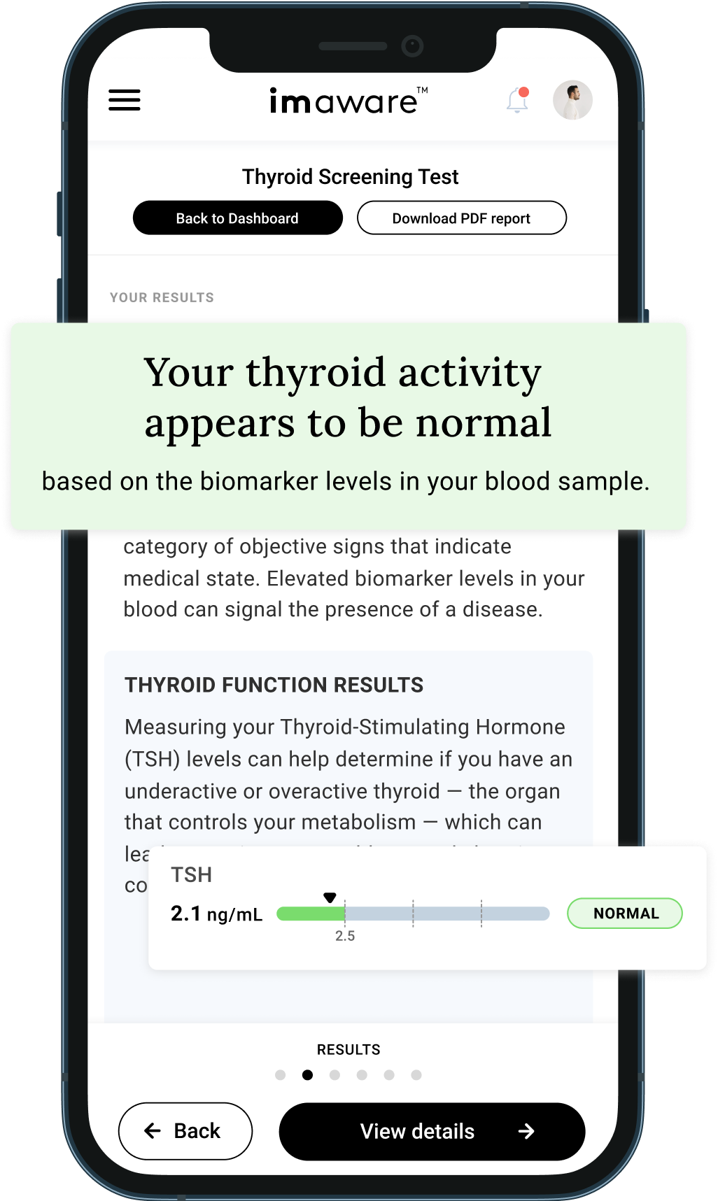 At Home Thyroid Test Kit | Doctor-Reviewed | imaware