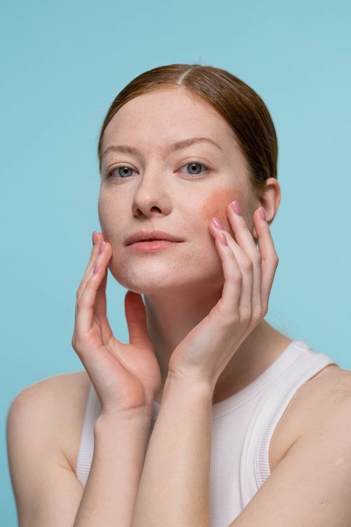 Looking Flushed Heres How To Get Rid Of Redness On Your Face Flip