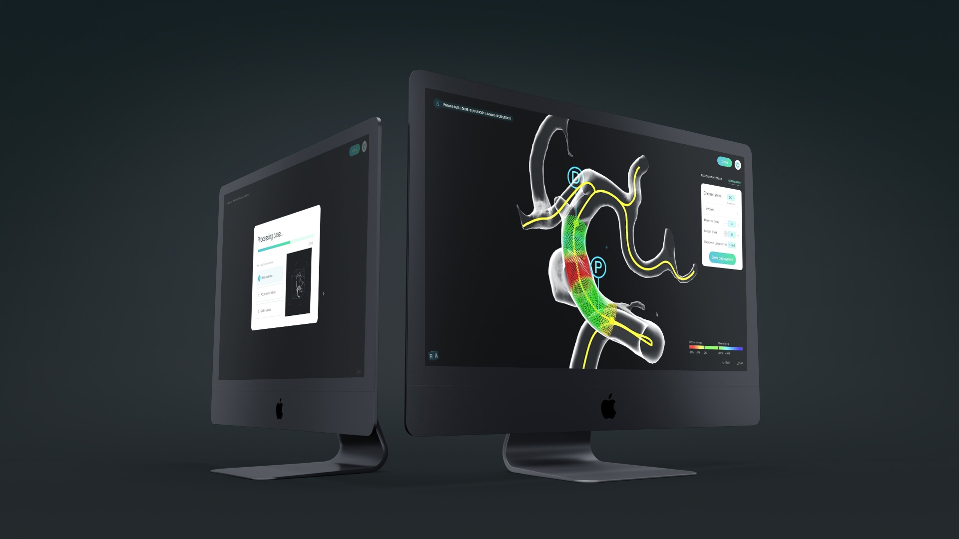 Oxford Heartbeat PreSize Neurovascular | Oxford Heartbeat